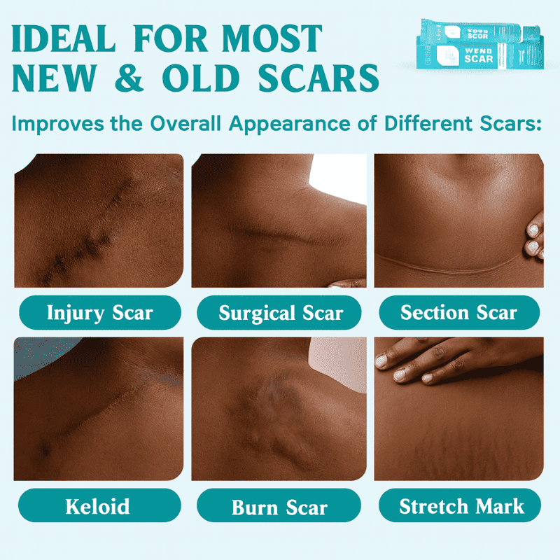 Scar – Multinofy